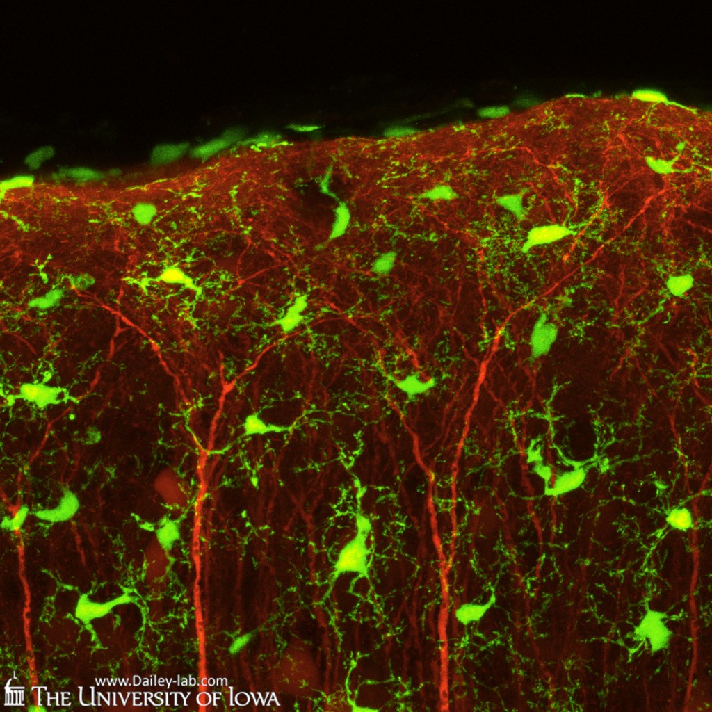 Are Microglia the Most Intelligent Brain Cells