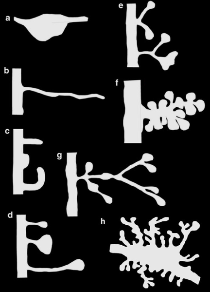 Many different types of dendrite spines