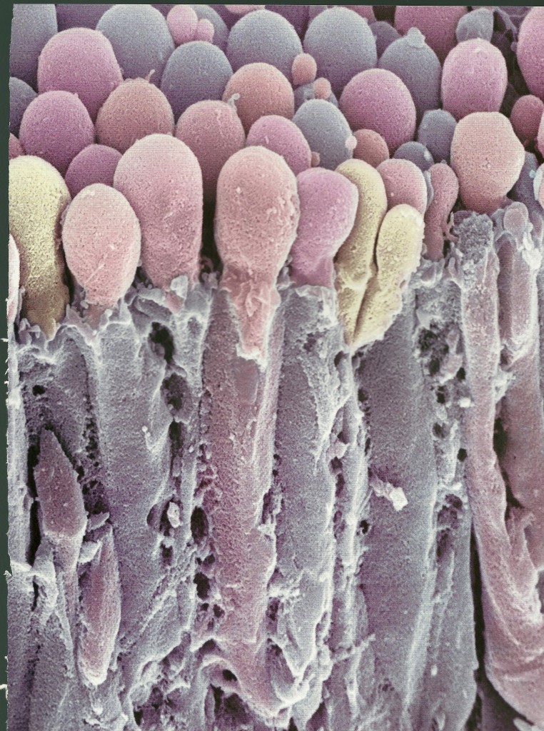 The Very Intelligent Choroid Plexus Epithelial Cell