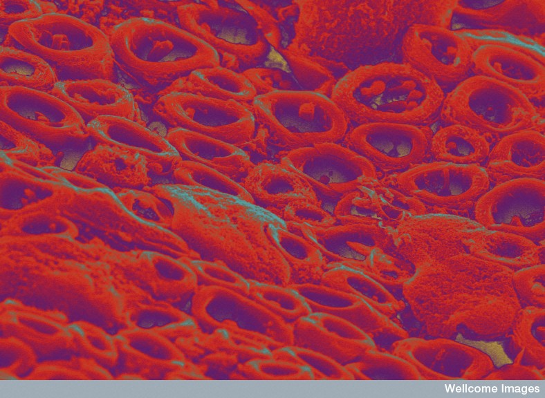 Myelin Facilitation of Whole Brain Neuroplasticity