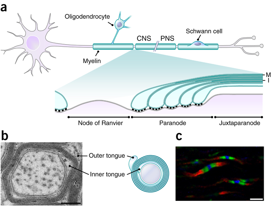 Myelin Facilitation of Whole Brain Neuroplasticity